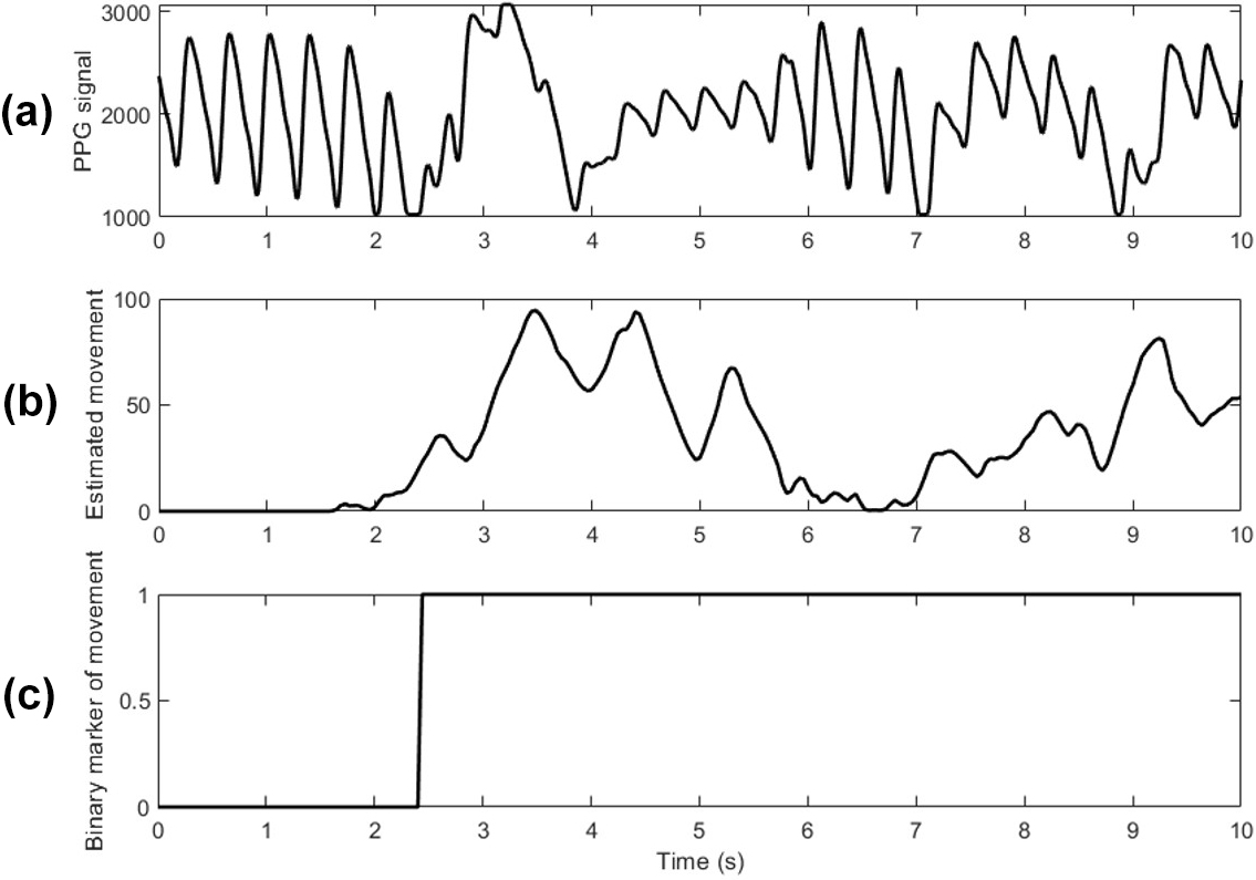 Mathematical Characterization of Preterm Infant Movement Over Time | SIAM