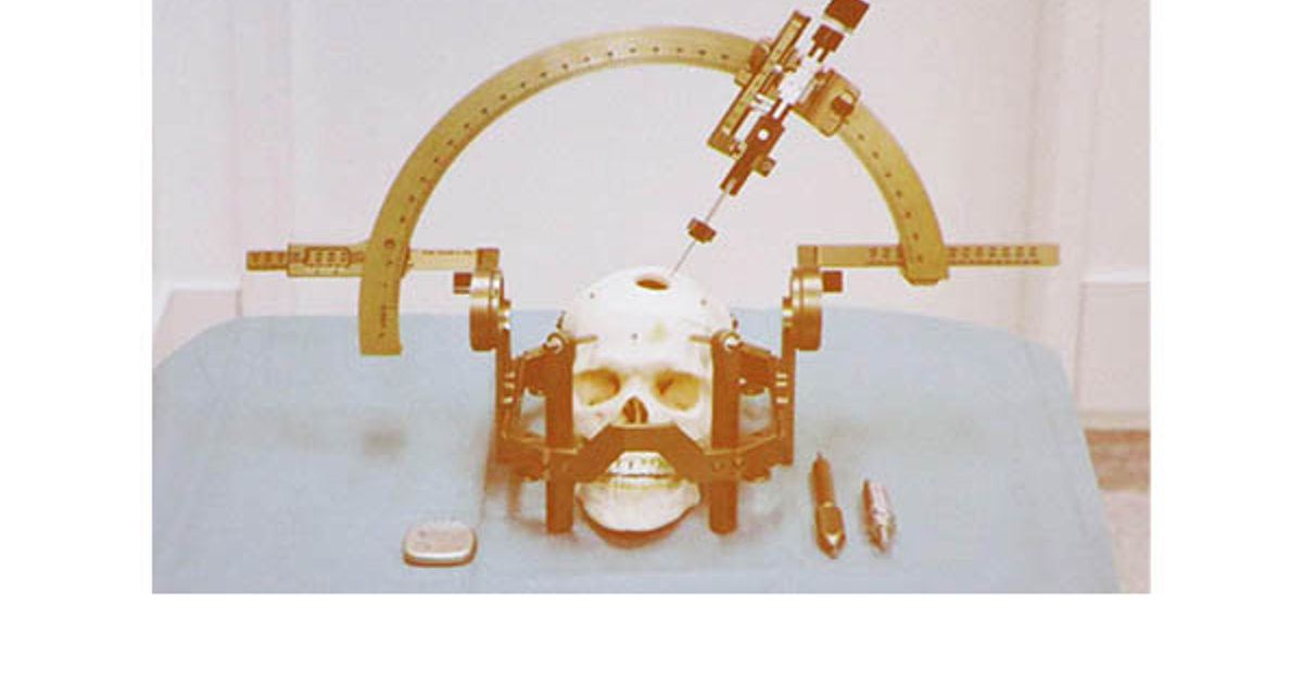 Optimal Path Planning of a Multi-tube Bent Cannula for Deep Brain ...