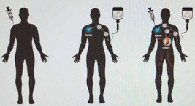 Oncolytic Viruses for Therapeutic Cancer Vaccination | SIAM