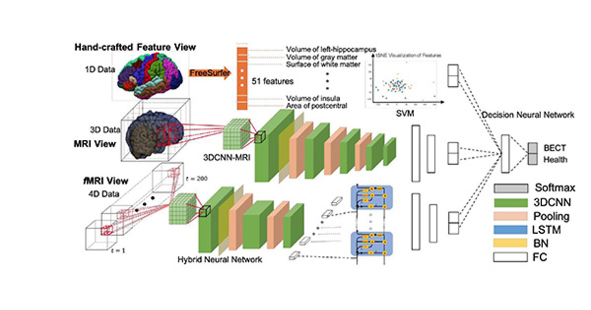 Detection of Epilepsy in Children Using Neural Network Methods | SIAM