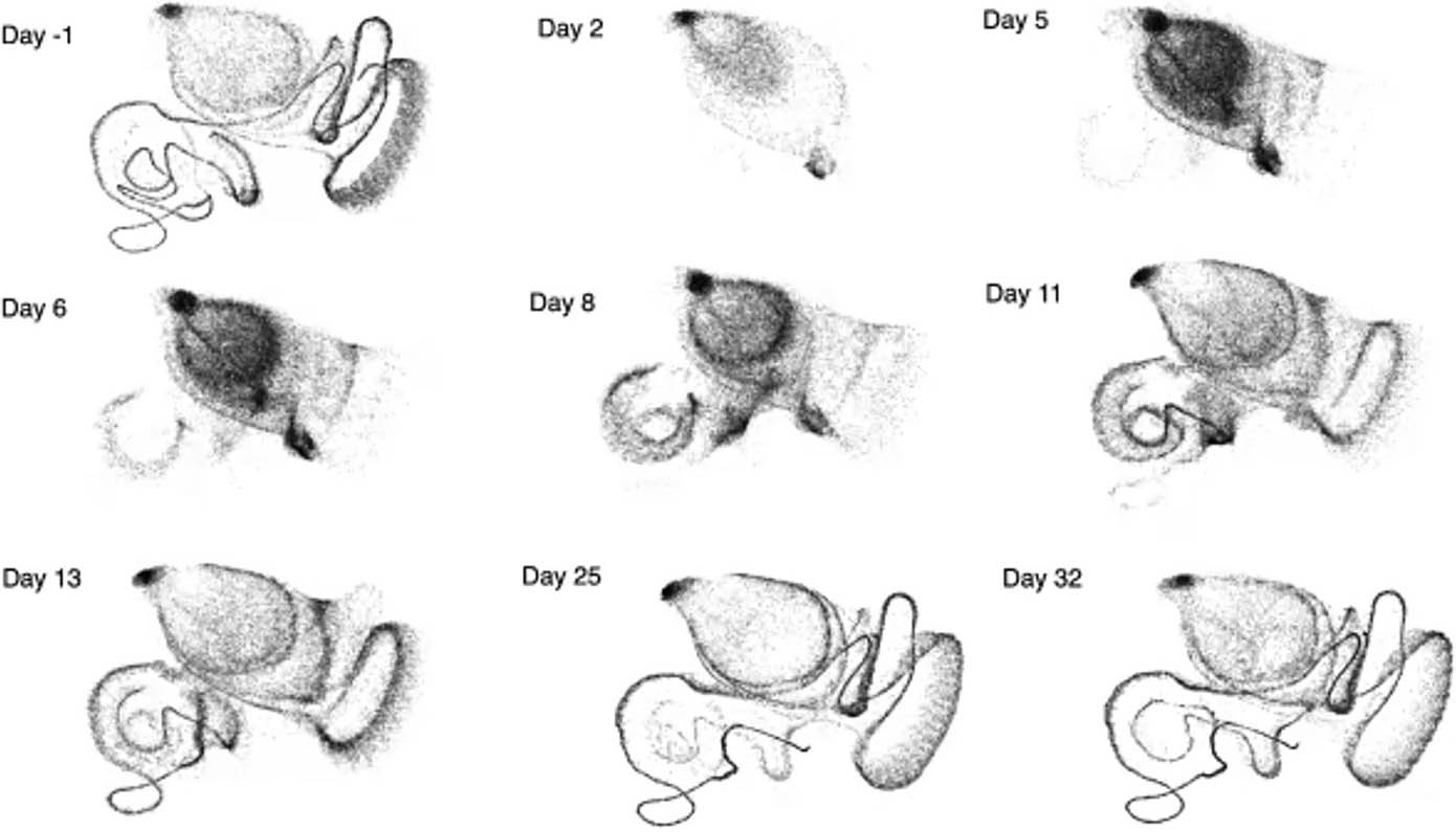 Understanding the Recovery of Robust Song Behavior in Zebra Finches ...