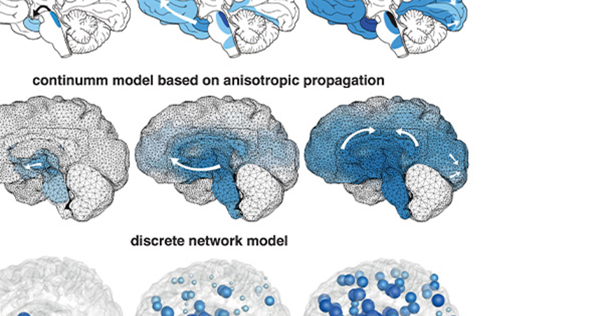 Multiscale Modeling of Dementia: From Proteins to Brain Dynamics | SIAM