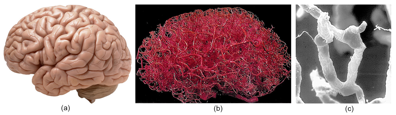 Modelling Drug Dynamics in the Brain | SIAM