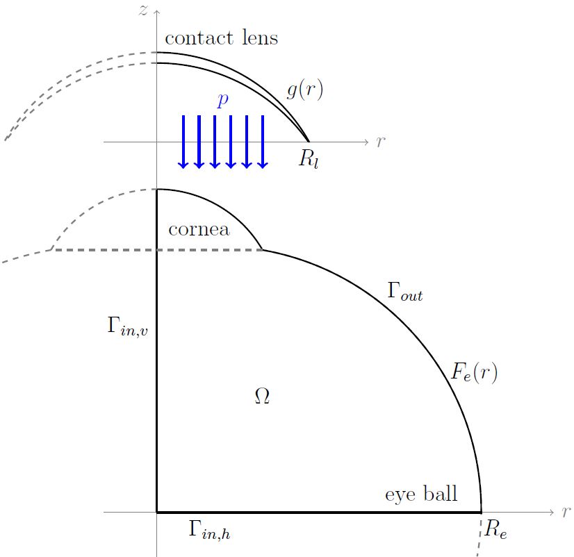 Mathematical Model Accounts for the Effect of Eye Deformation on ...