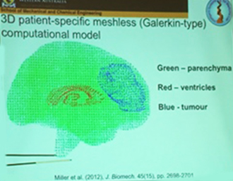 Image-Guided Neurosurgery: Computation of Brain Deformations | SIAM