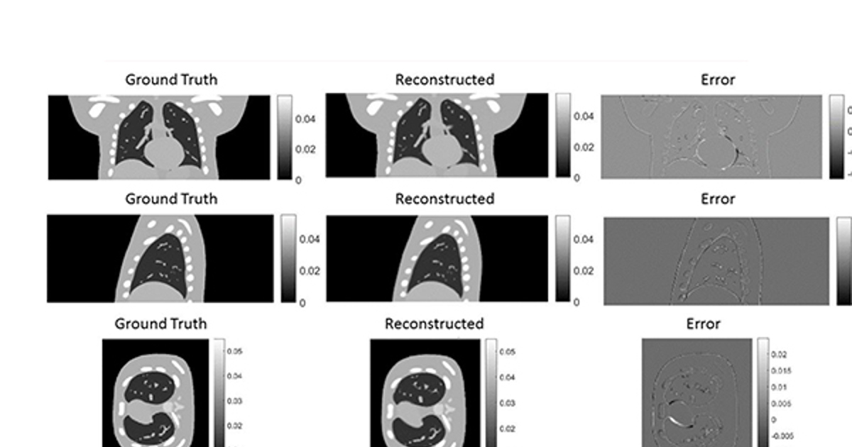 Achieving Real Time Cone Beam Ct Reconstruction Siam