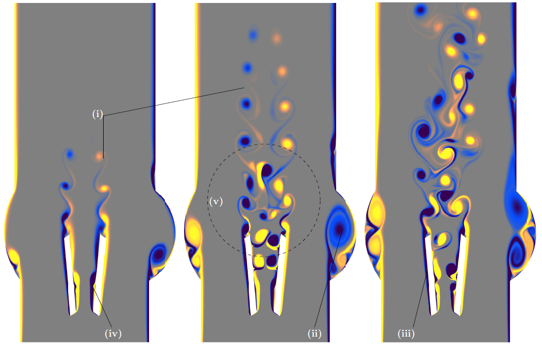 Hydrodynamic Instabilities and Laminar-turbulent Transition in Mechanical Heart Valves | SIAM