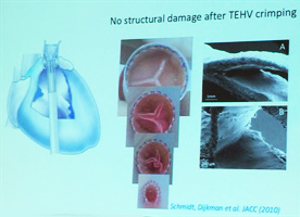 Computationally Modeling Tissue-Engineered Heart Valves | SIAM