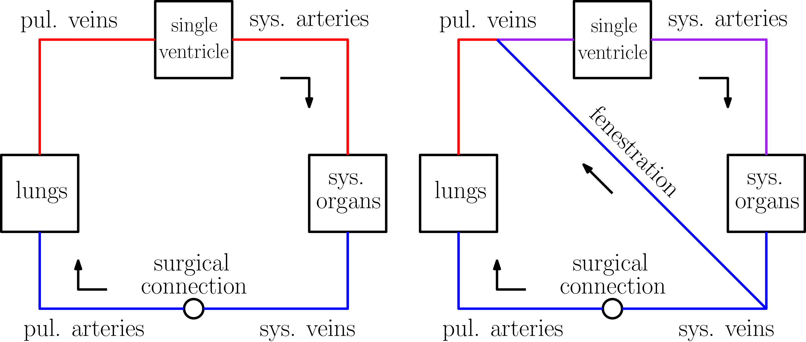Circulation Models Assess the Impacts of Congenital Heart Defects and ...