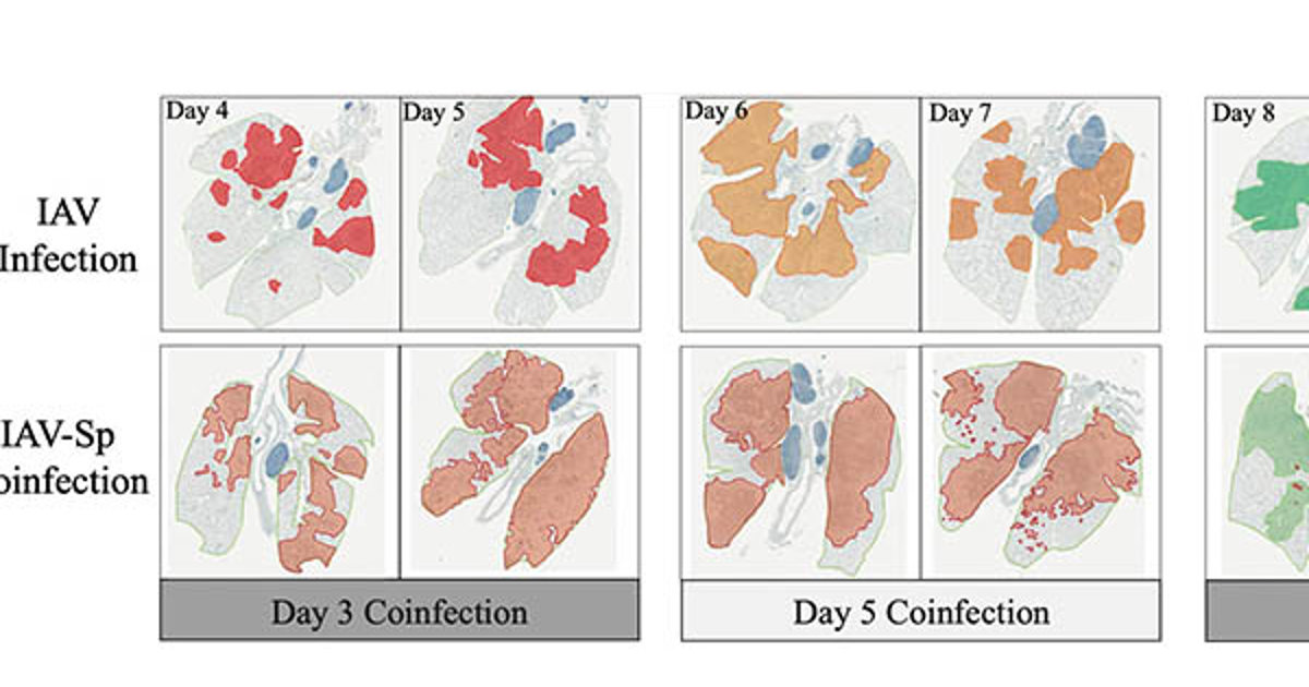 Modeling the Severity of Influenza-Bacteria Coinfections | SIAM