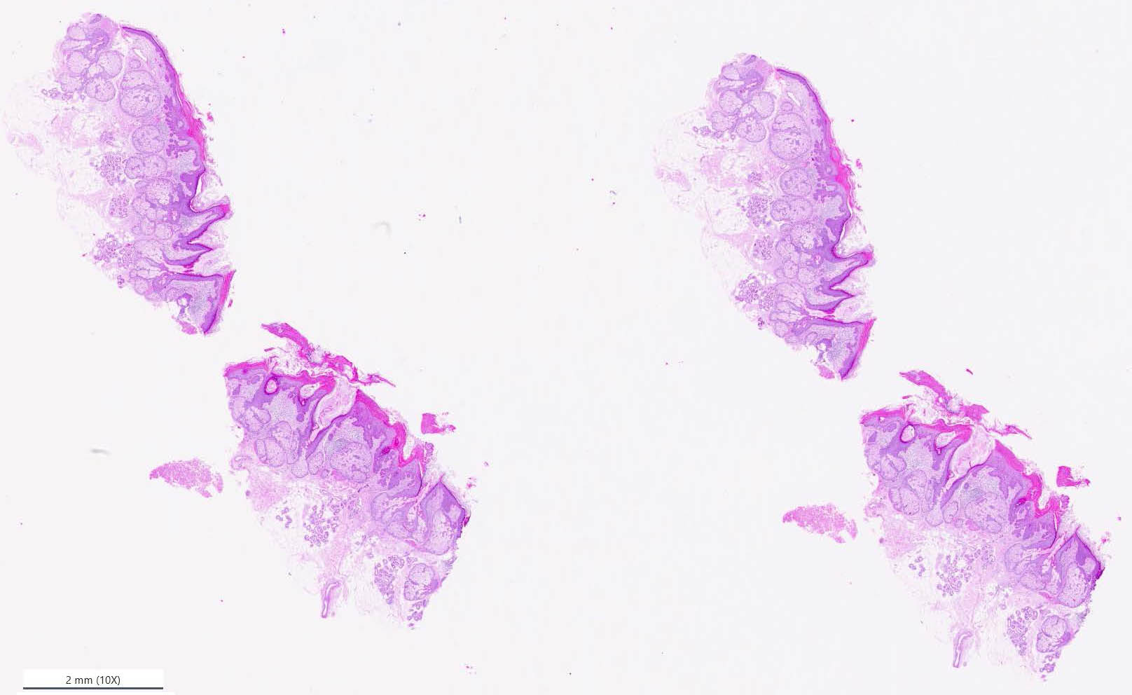 Deep Learning for Digital Pathology: Detecting Skin Diseases with ...