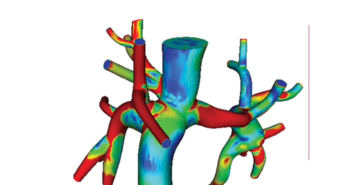 Cardiovascular Blood Flow Simulation | SIAM