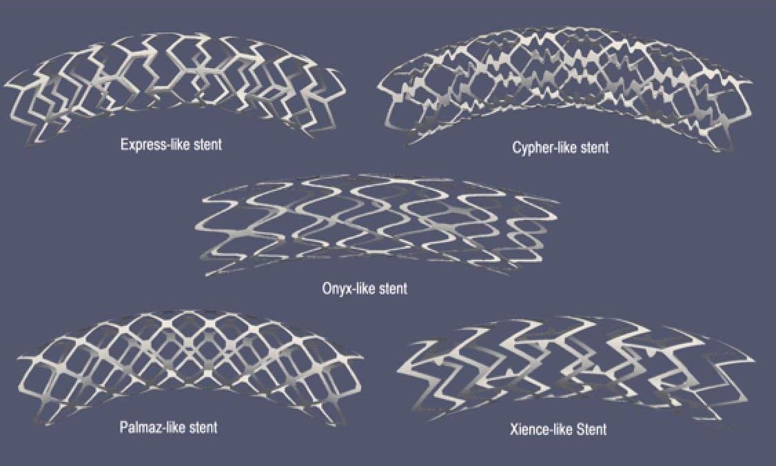 Mathematical Model Reveals Possible Role of Drug-Eluting Stents in ...