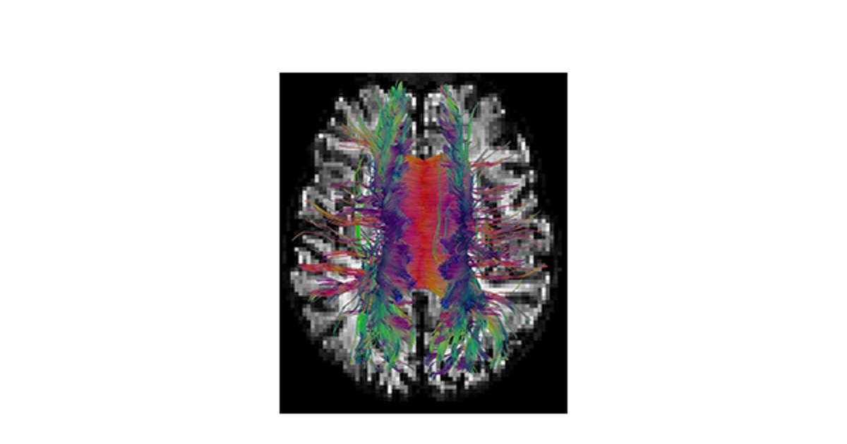 Prize Spotlight: Lek-Heng Lim | SIAM