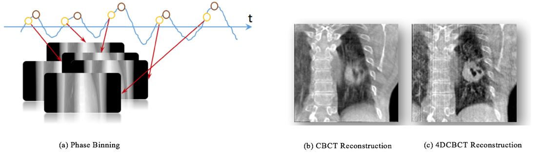 Achieving Real Time Cone Beam CT Reconstruction | SIAM