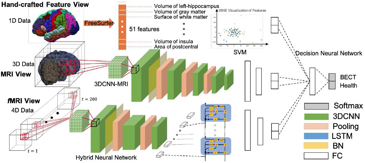 Detection of Epilepsy in Children Using Neural Network Methods | SIAM