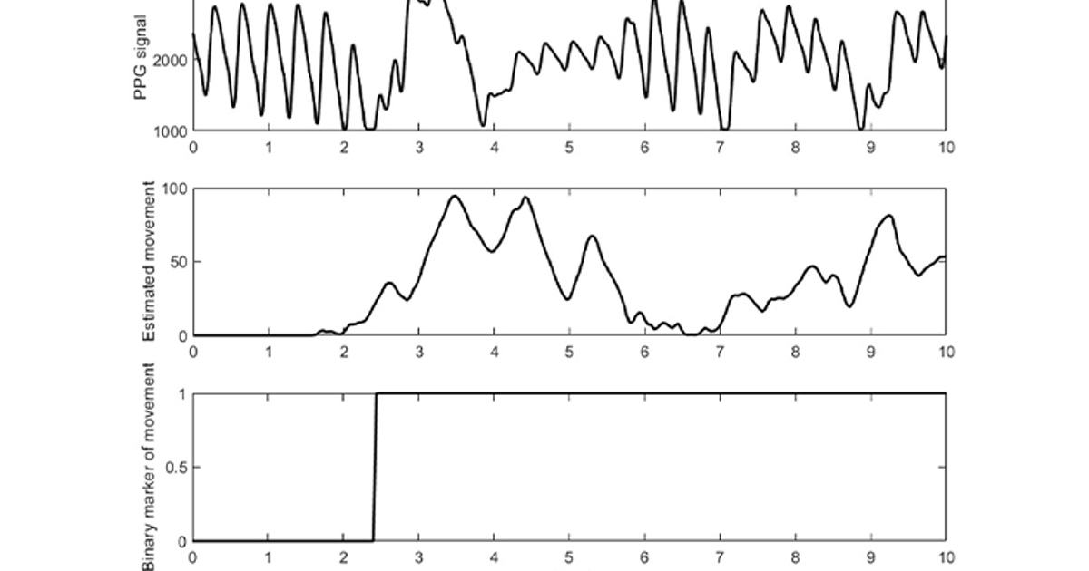 Mathematical Characterization of Preterm Infant Movement Over Time | SIAM