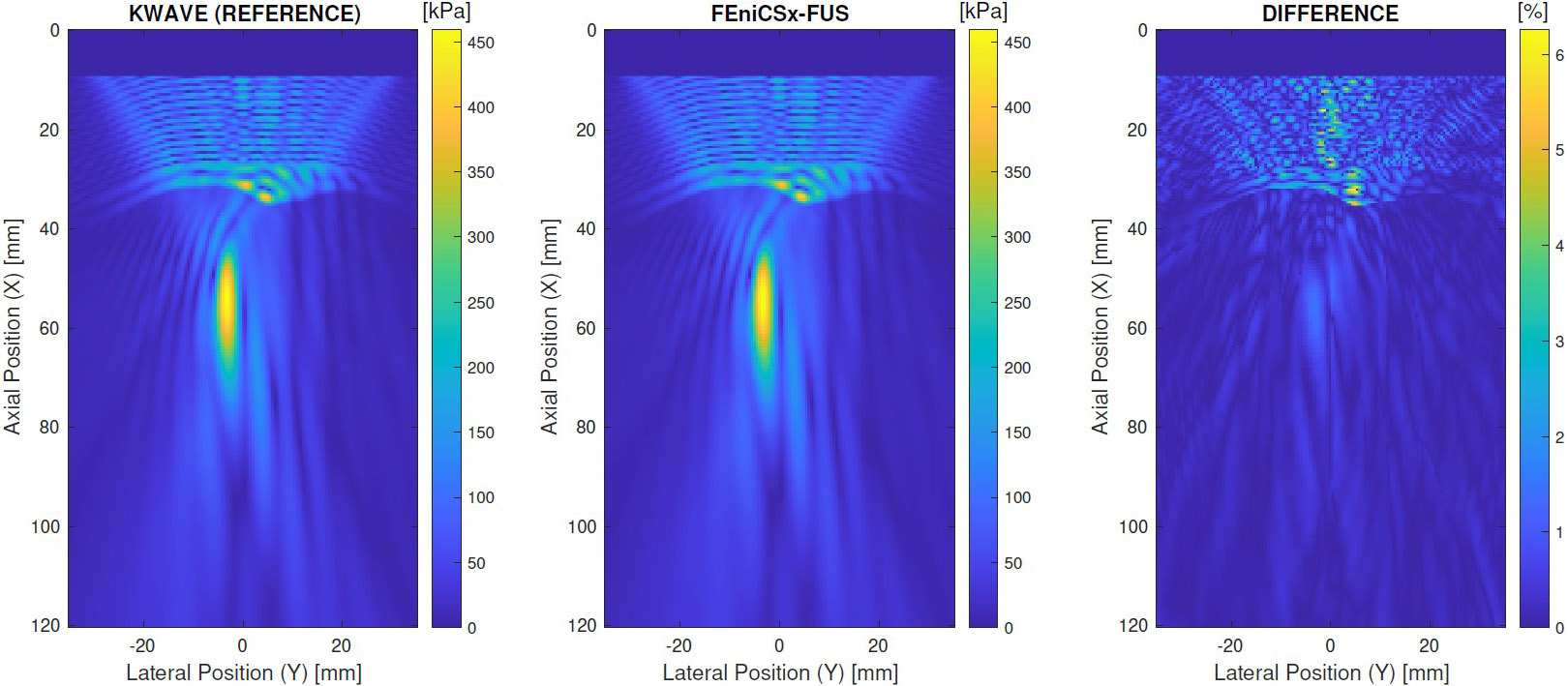 A Fast Finite Element Solver For Focused Ultrasound Applications Siam