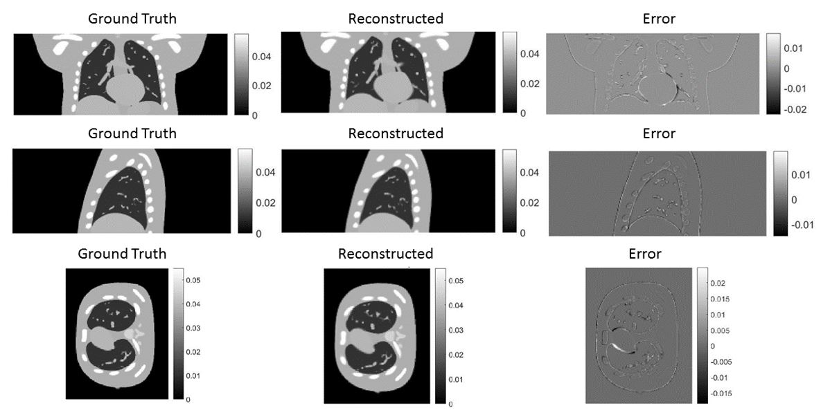 Achieving Real Time Cone Beam CT Reconstruction | SIAM