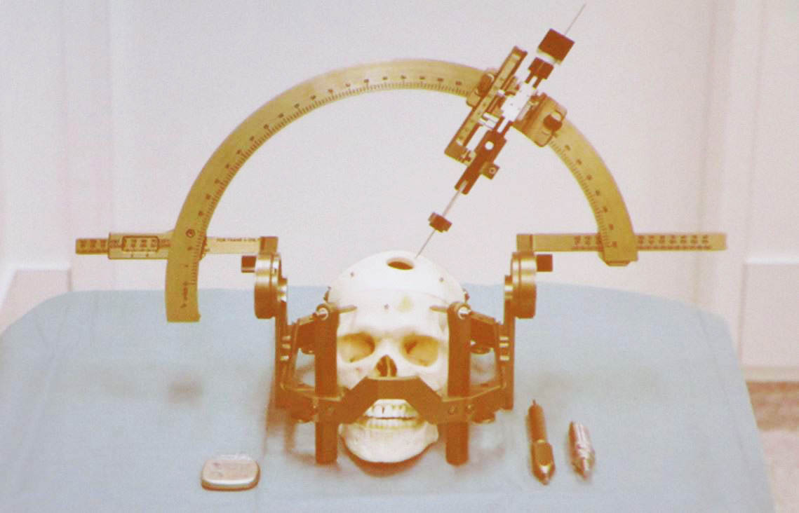 Optimal Path Planning of a Multi-tube Bent Cannula for Deep Brain ...