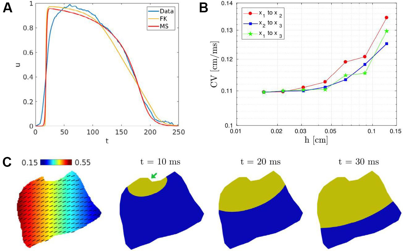 Estimating Patient-Specific Cardiac Conductivities: A Challenge Between ...