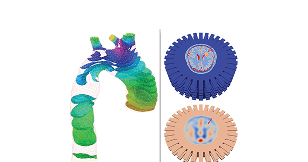 FreeFem++: A High Level MultiPhysics Finite Element Software | SIAM